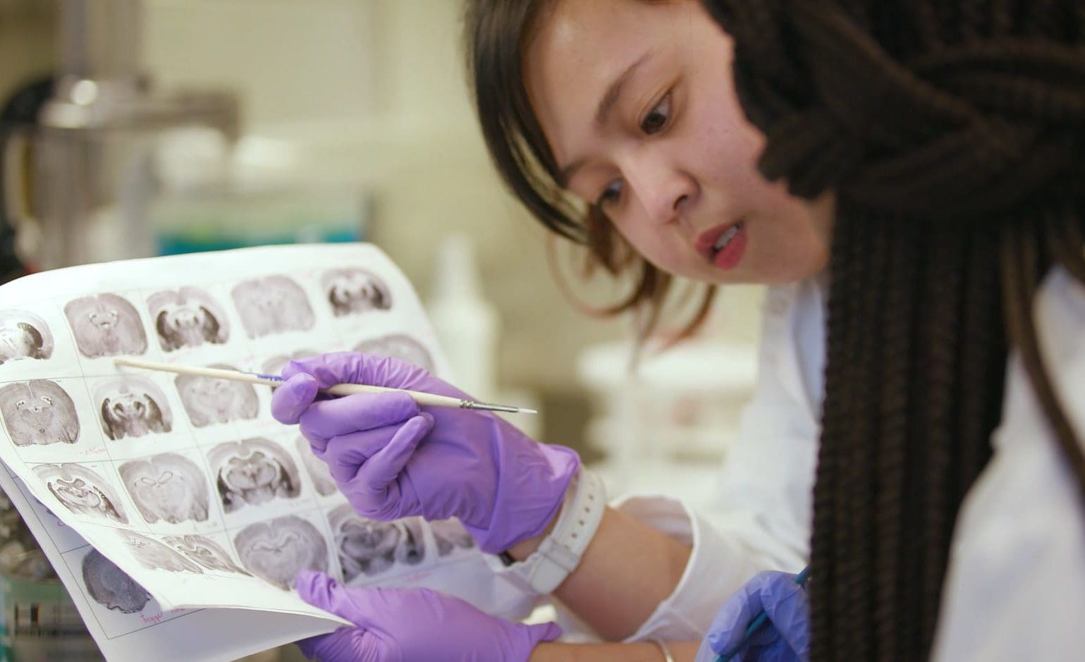 Home - UW Diabetes Institute